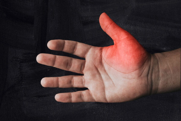 Gamer's Thumb: Most Common Hand Injury in Esports - CS LAB